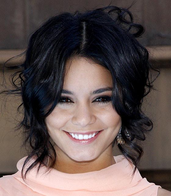 Big Forehead Unattractive