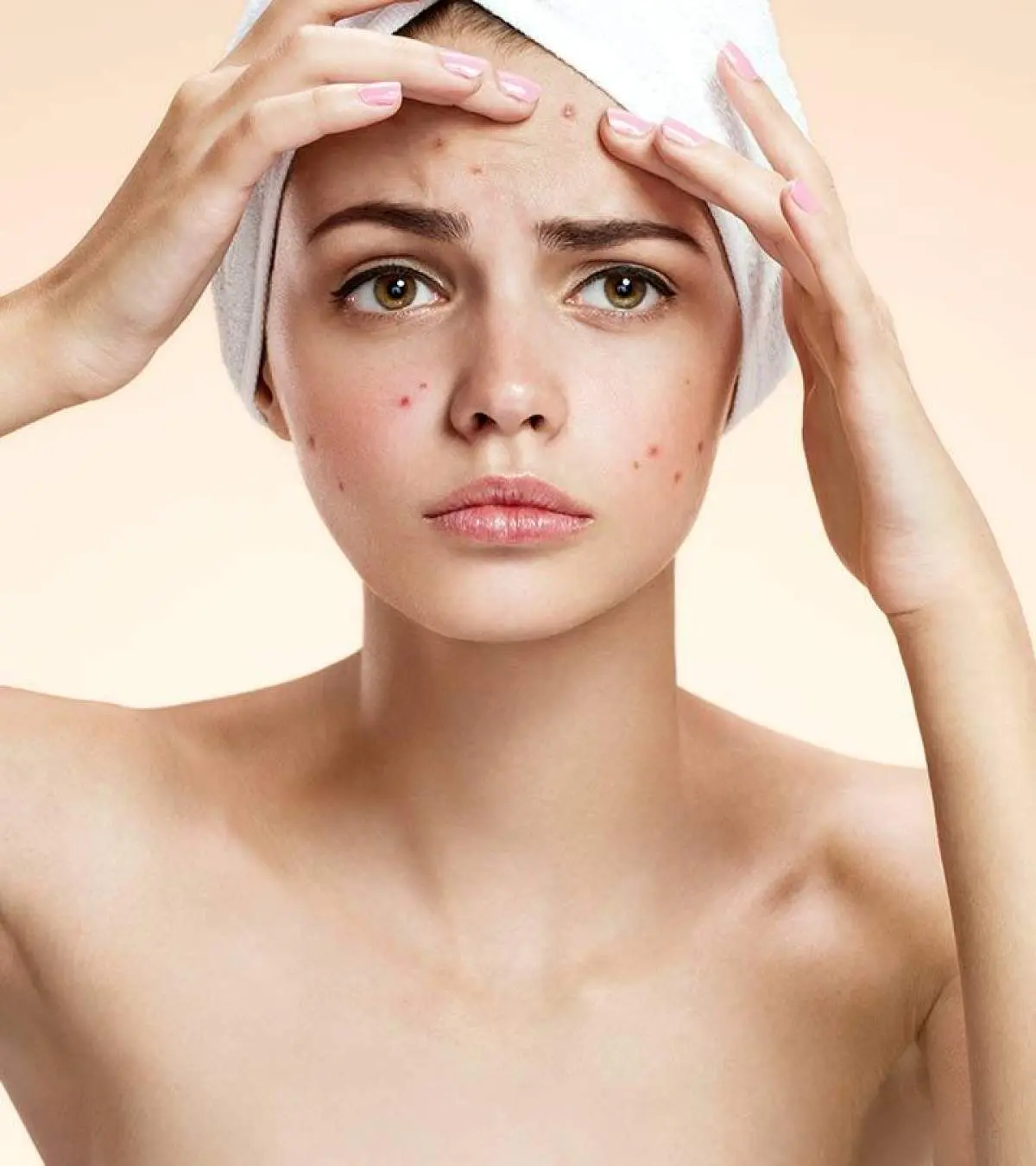 Home Remedies For Blemishes: 19 Easy Kitchen Solutions