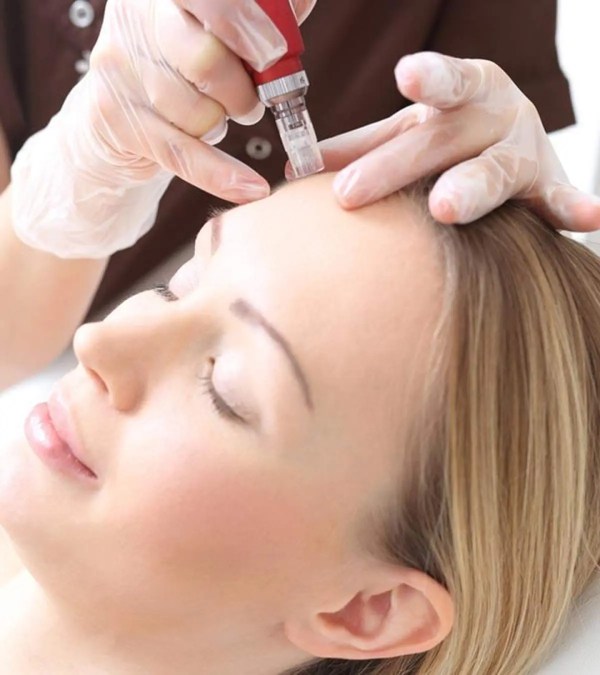 Mesotherapy For Face: 5 Key Benefits To Rejuvenate Skin