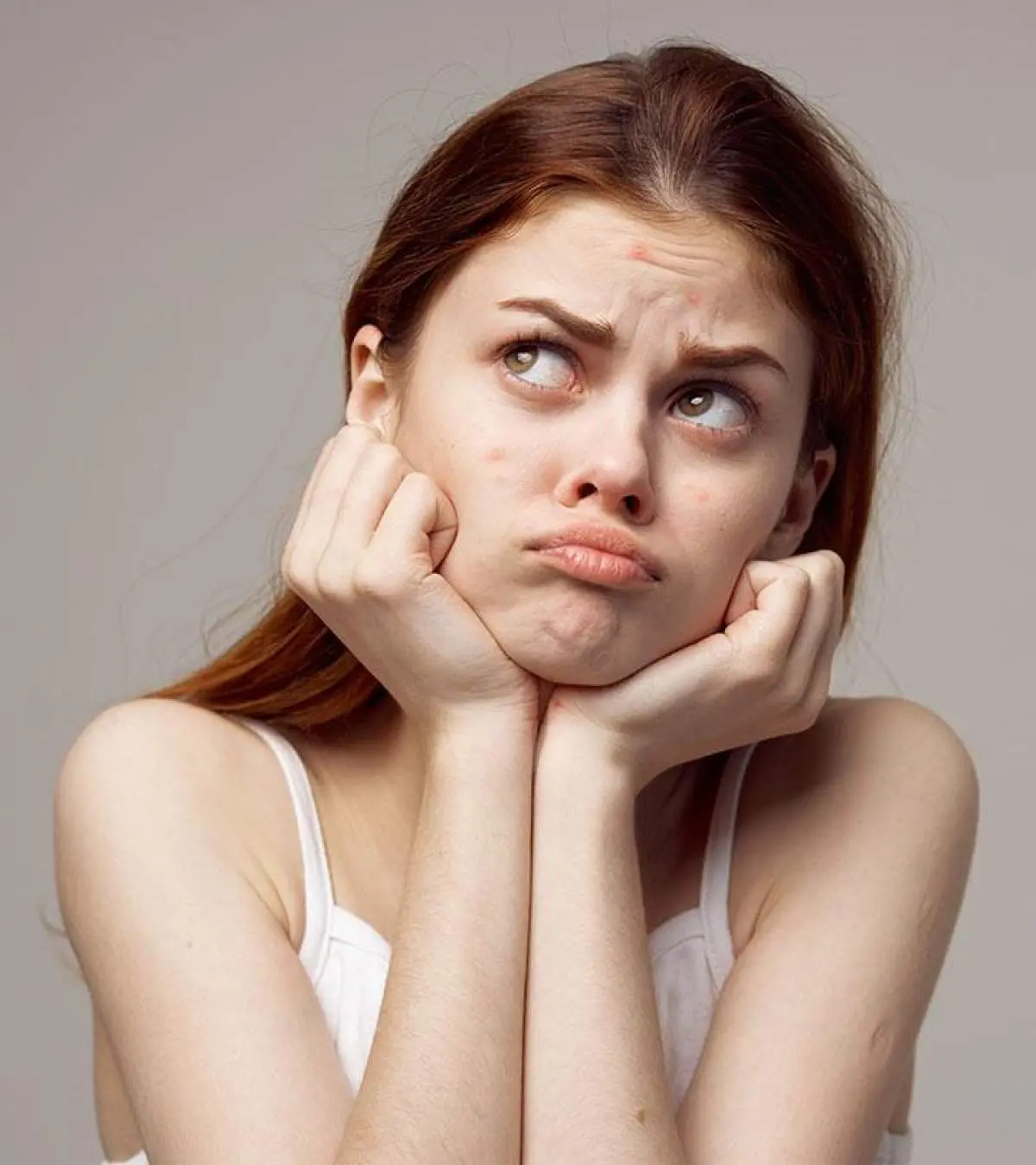 Forehead Acne: 9 Natural Remedies For Clear Skin