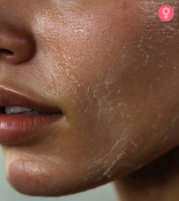 Skin Peeling: Causes, Symptoms, And How To Reduce It