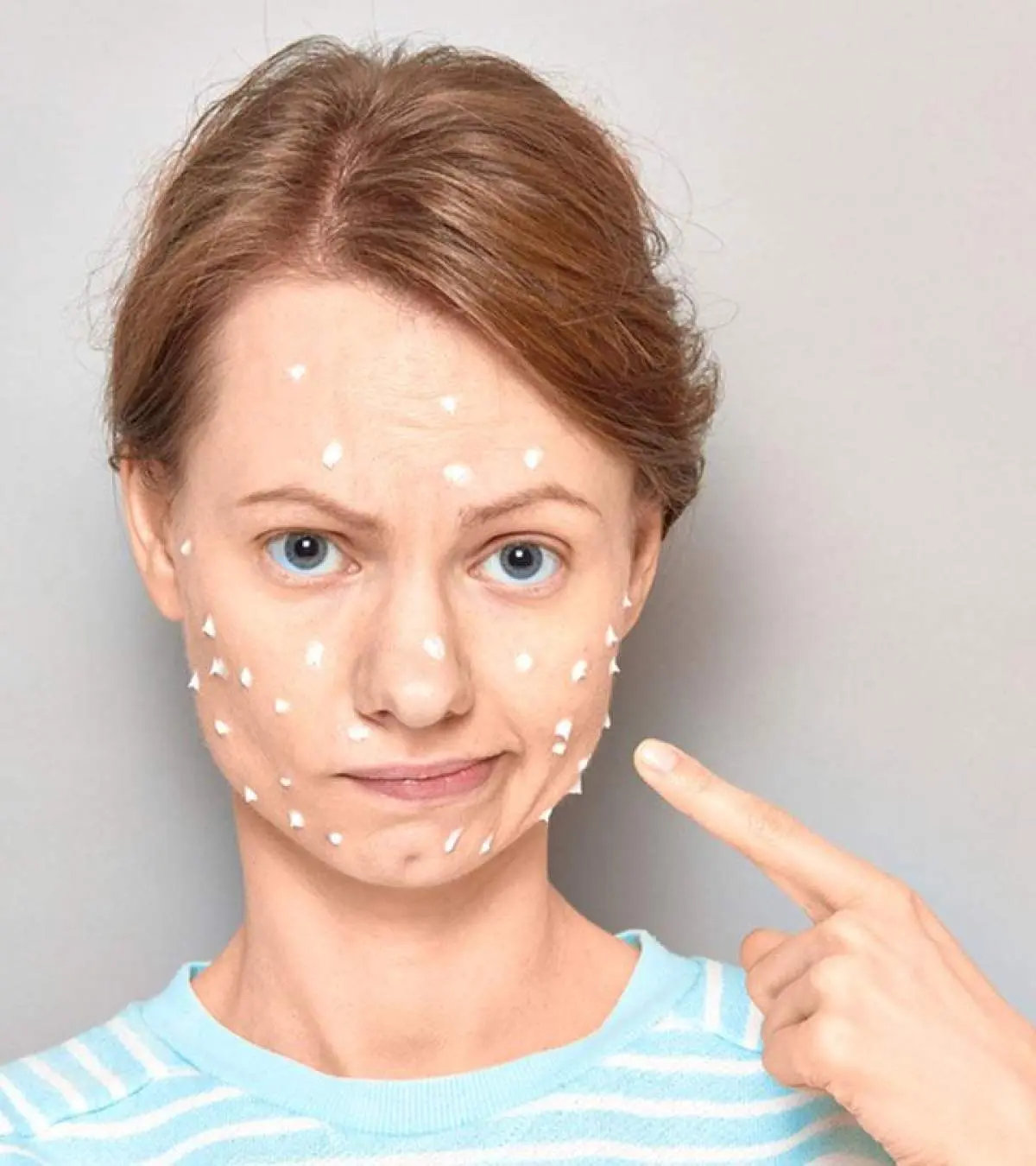 Toothpaste For Pimples Does It Really Work