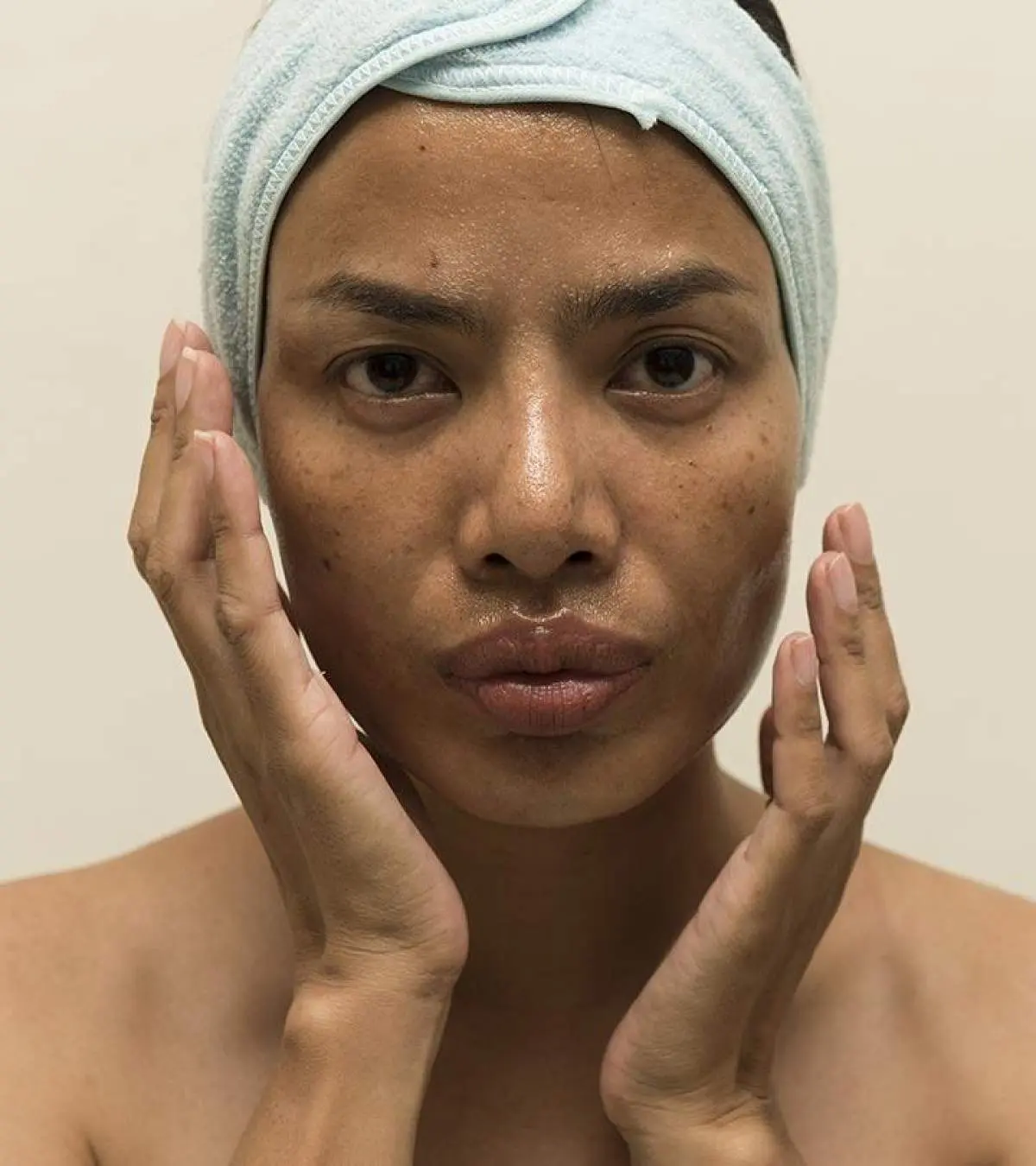 Diet For Oily Skin: 12 Best Foods To Eat And 9 To Avoid
