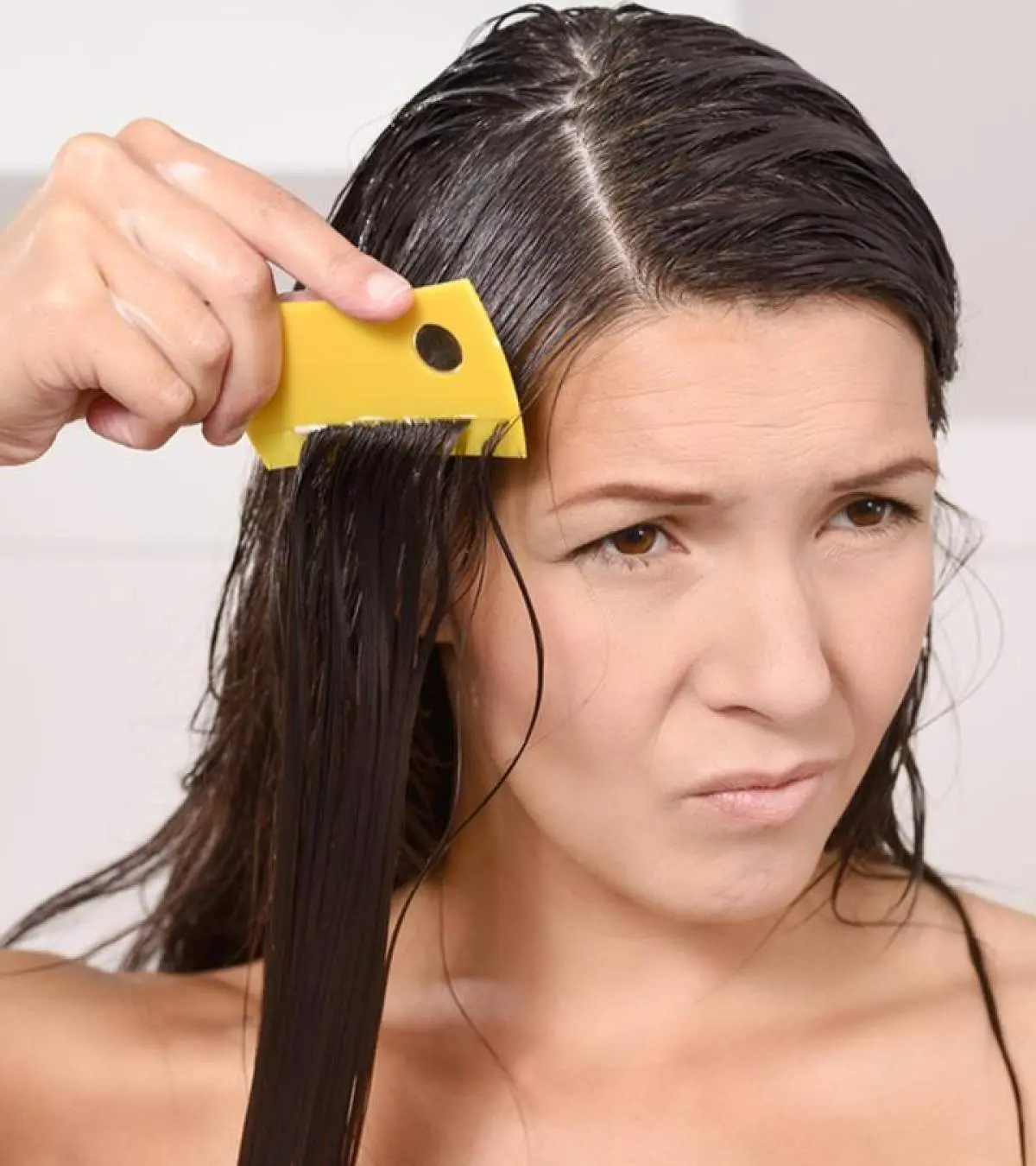 How To Get Rid Of Head Lice: Removal & Prevention Guide