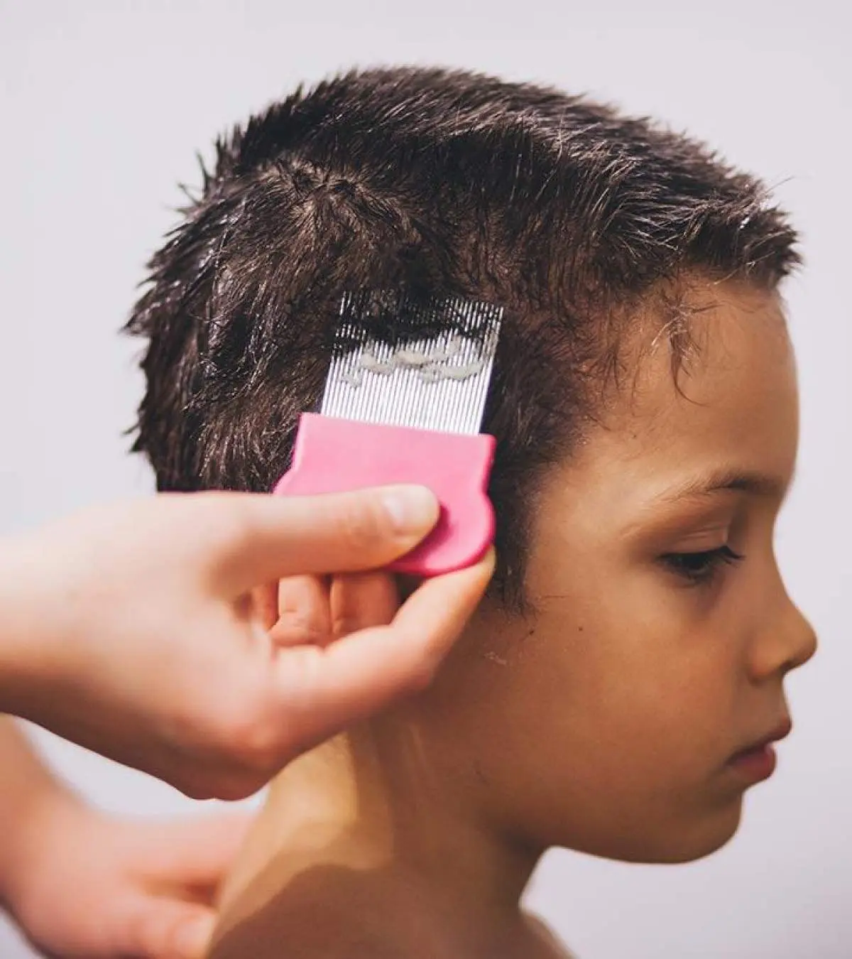 Hair Loss In Children: 8 Common Causes And Prevention Tips