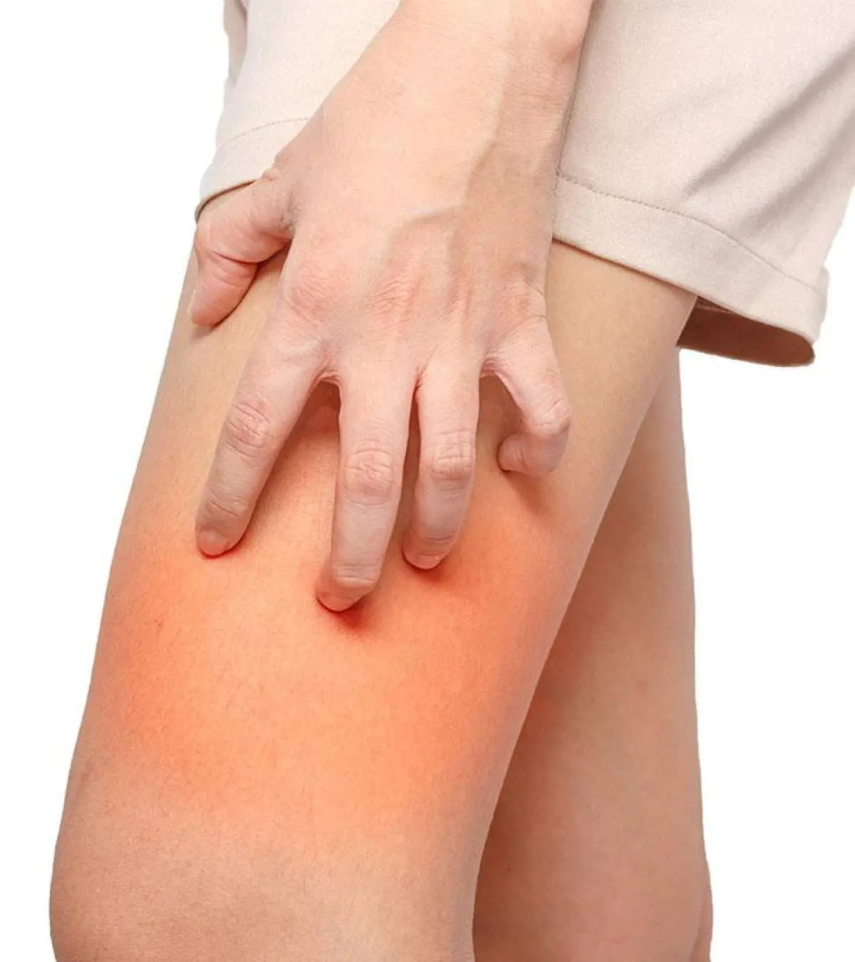 Home Remedies For Chafing: 14 Fast, Effective Relief Treatments