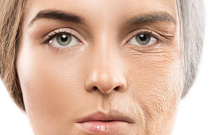 8 Amazing Benefits Of Alpha Hydroxy Acid For Your Skin