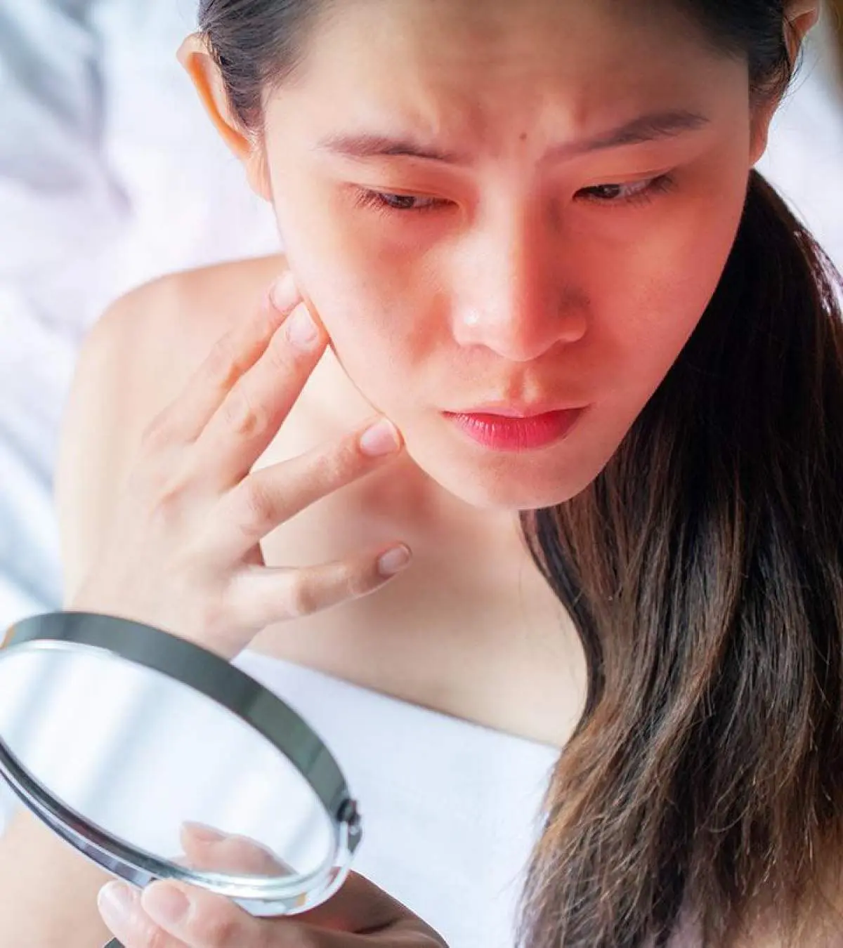 How To Reduce Redness On Face: 10 Natural Remedies