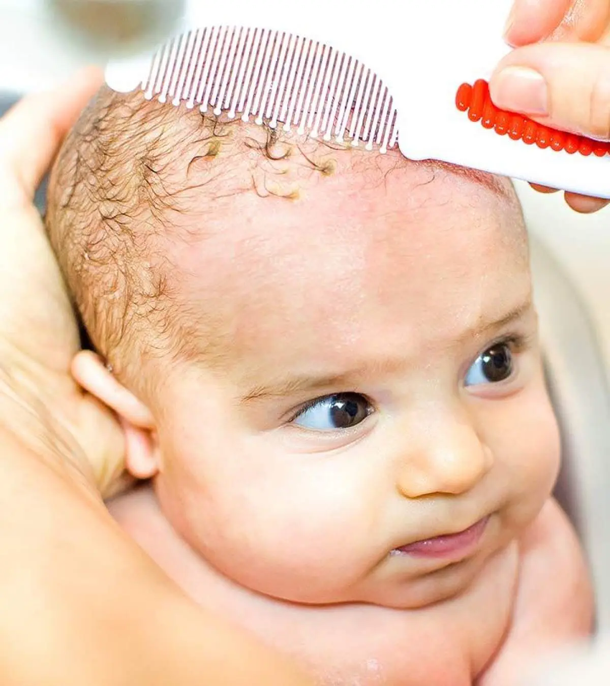 Cradle Cap Remedies: 13 Natural Fixes For Flaky Baby Scalp