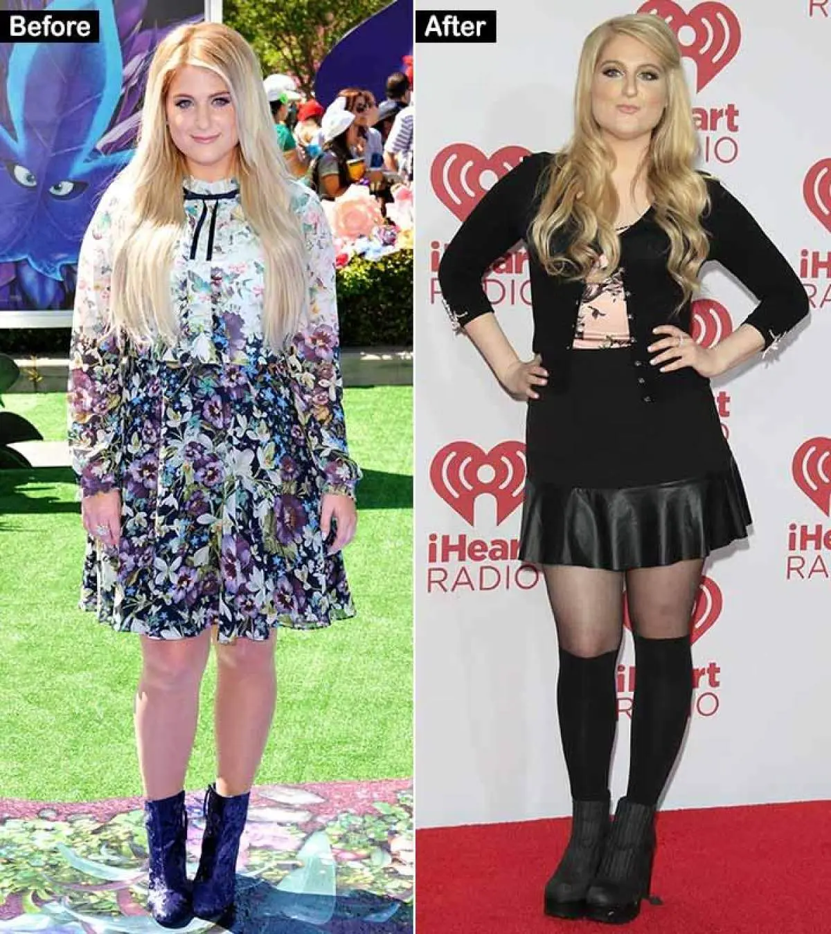 Meghan Trainor Weight Loss: 13 Diet And Workout Secrets