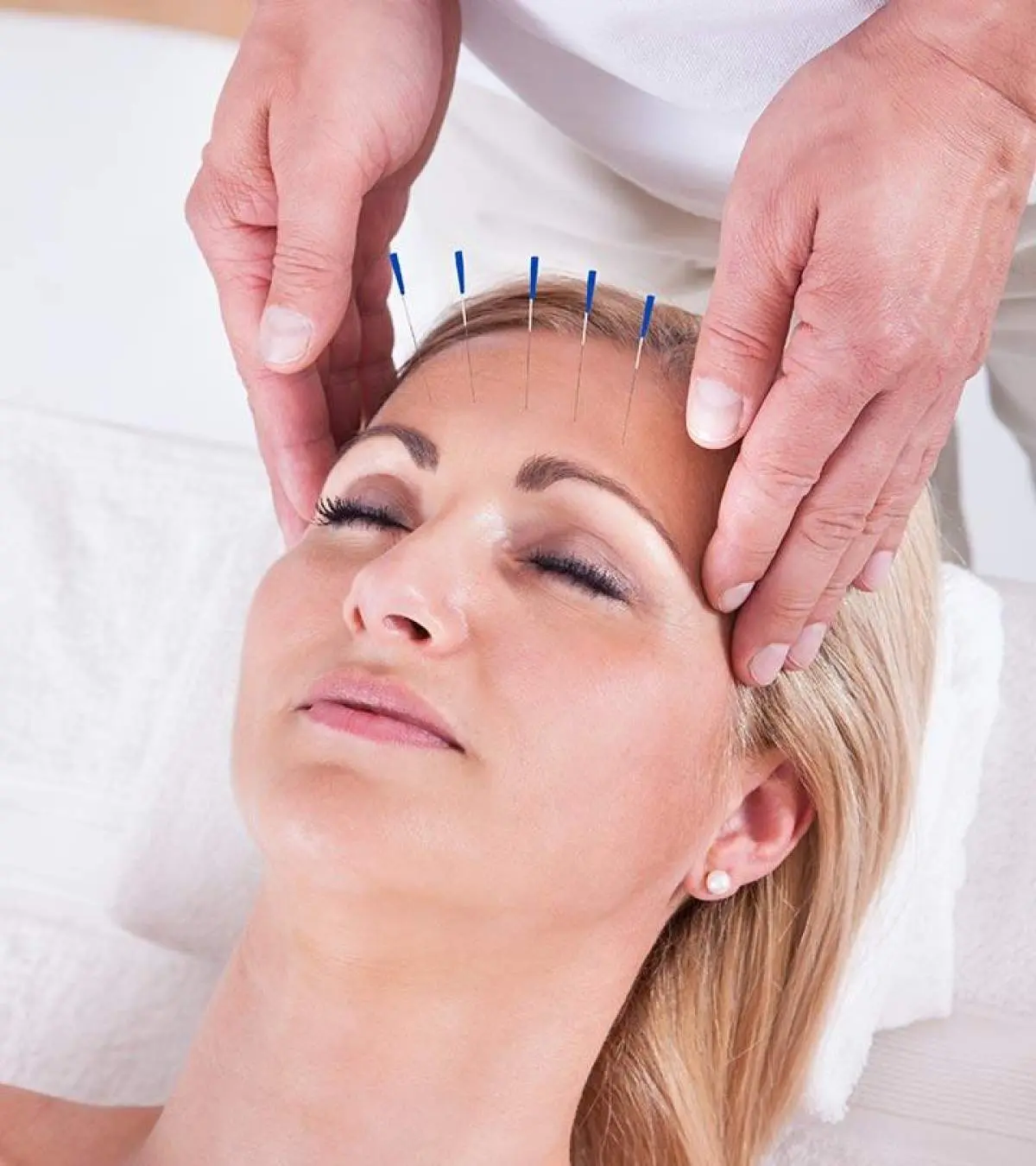 Facial Acupuncture Risks: 5 Side Effects, Cost & Care