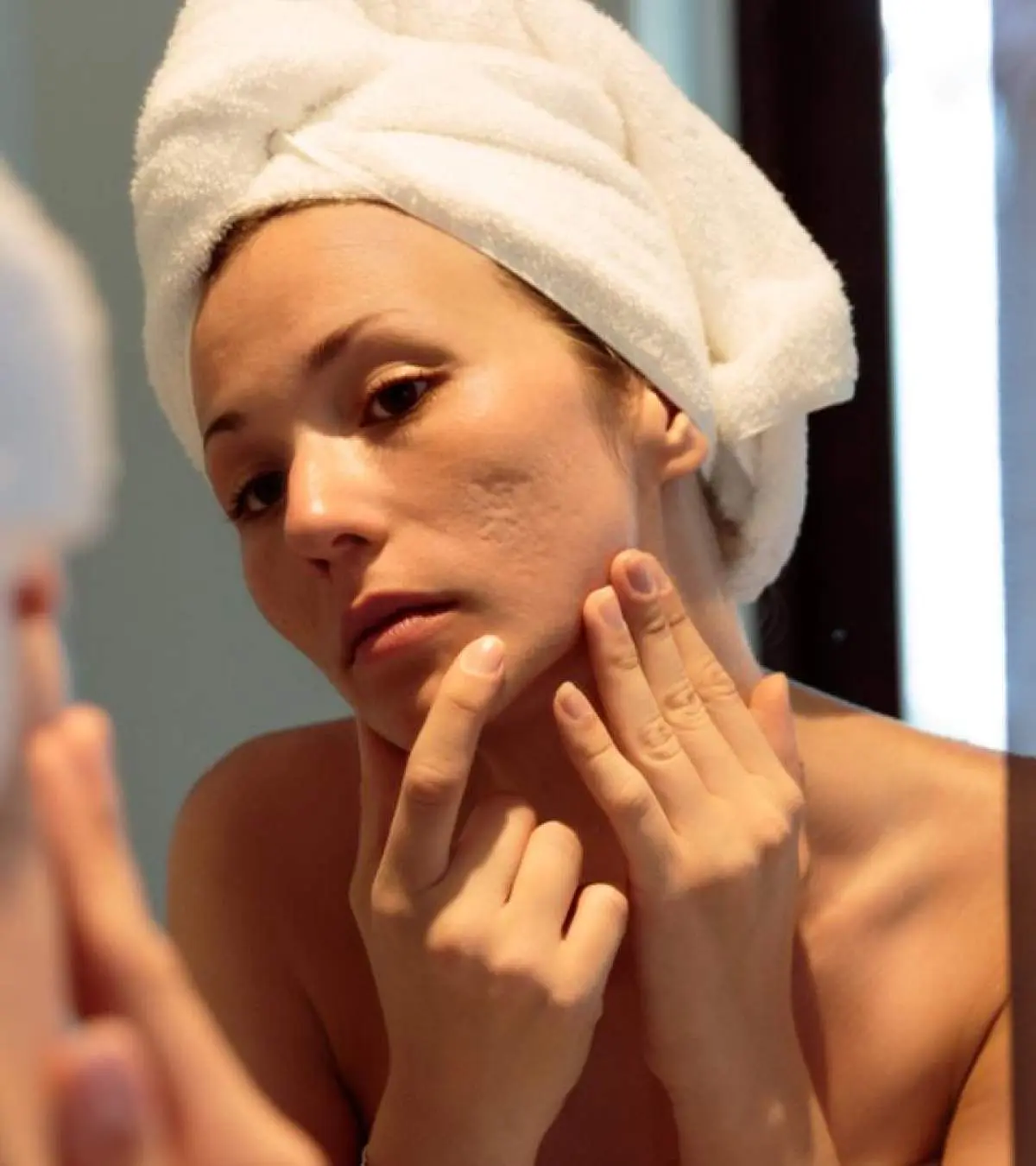 How To Get Rid Of Pockmarks: 7 Proven Treatments