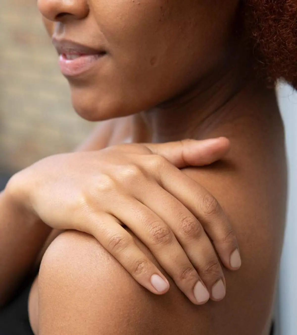Stretch Marks On Shoulders: Expert Tips For Fading And Hiding