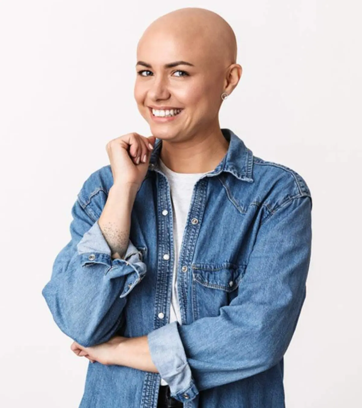 Genetic Hair Loss: Causes, Symptoms, And 2 Proven Treatments