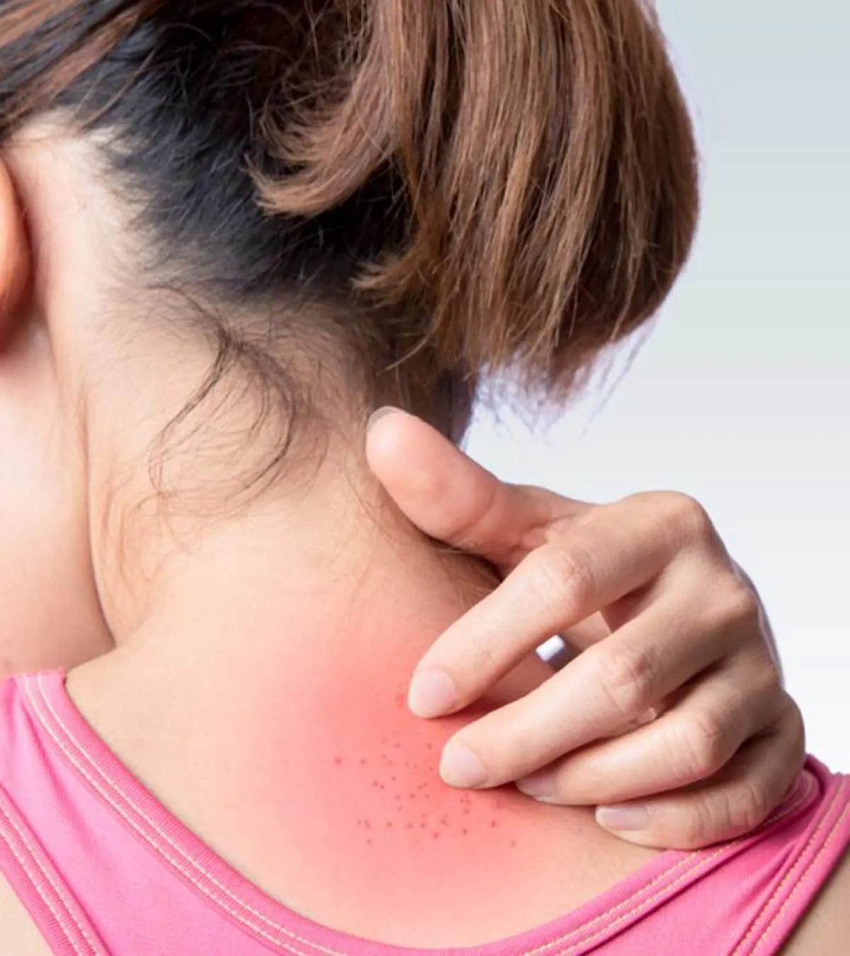 How To Get Fiberglass Out Of Skin: 4 Safe Home Methods