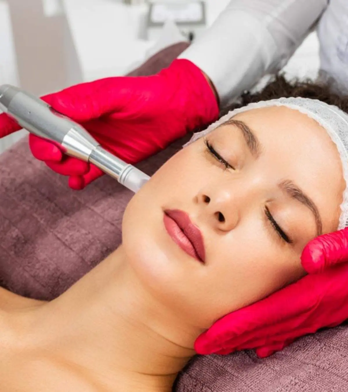 Microneedling: A Comprehensive Guide With 5 Key Benefits