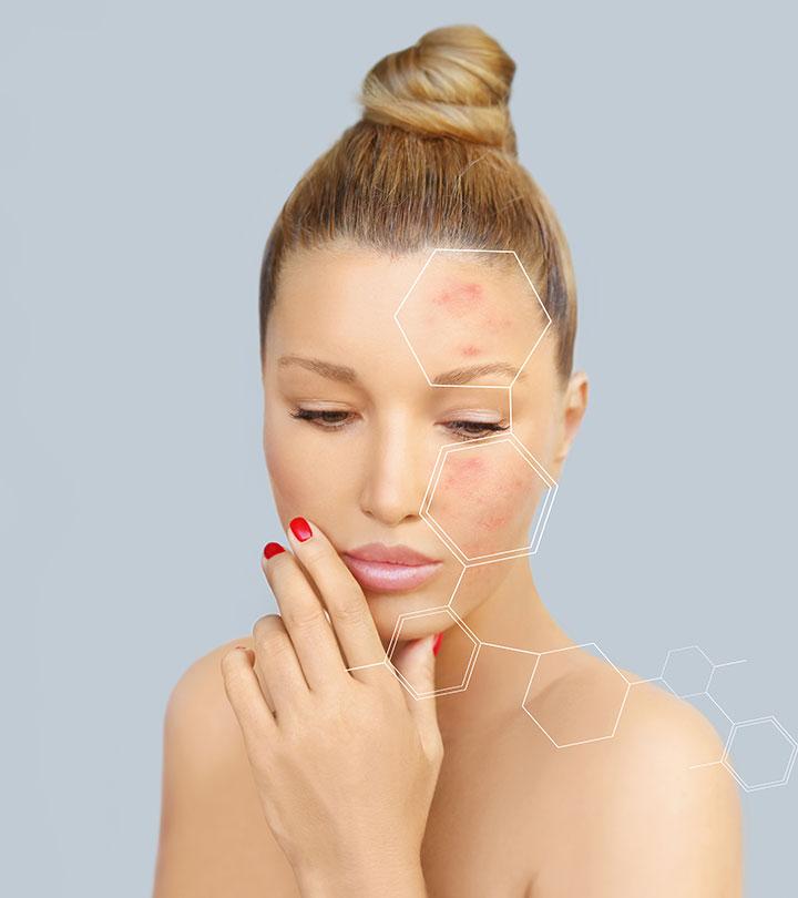 Hydroquinone Cream Side Effects