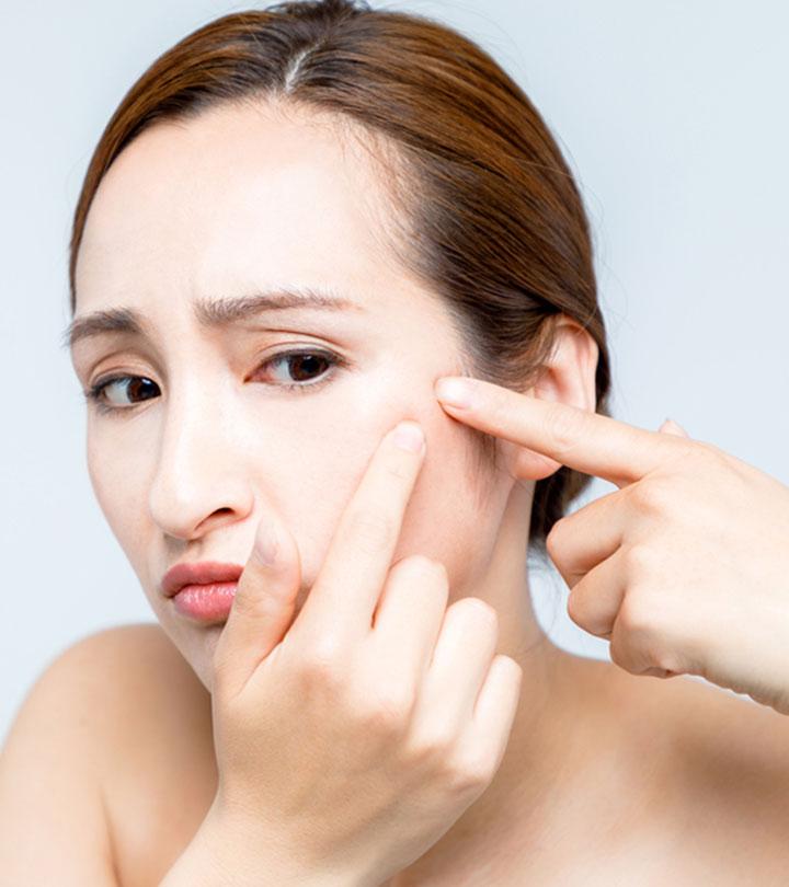 How To Get Rid Of Scabs On Face How To Get Rid Of Scabs On Face