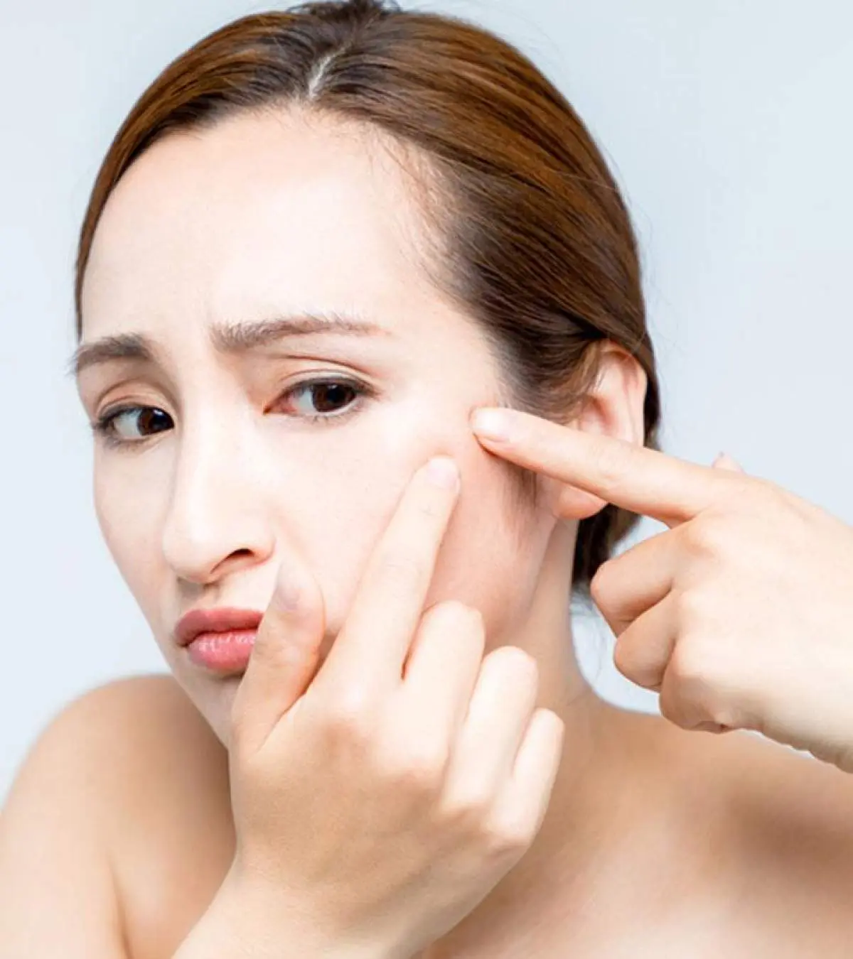 Scabs On Face: 5 Easy Home Remedies For Faster Healing