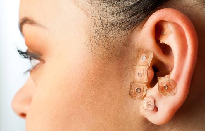 Ear Piercing Acupuncture Points: Beauty Aligned With Wellness