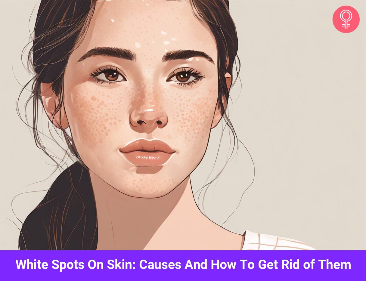 White Spots On Skin: Causes And How To Get Rid of Them